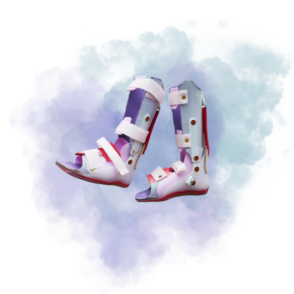 Orthosis - Beverly orthopedic laboratory.